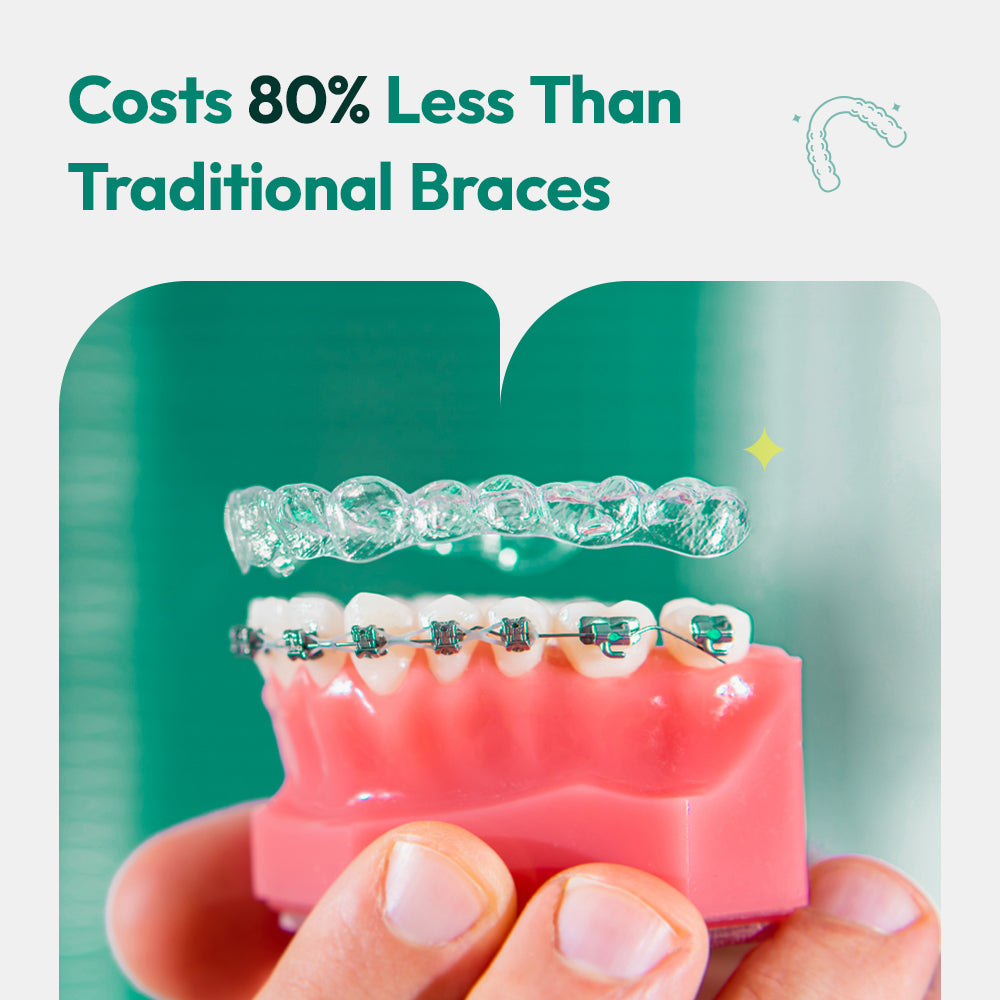 Most Affordable Night-Only Aligners Plan