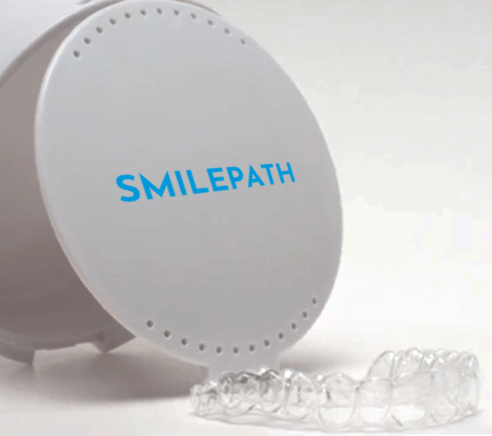SmilePath Flex Pro Single Arch Aligners: Targeted Alignment for Upper ...